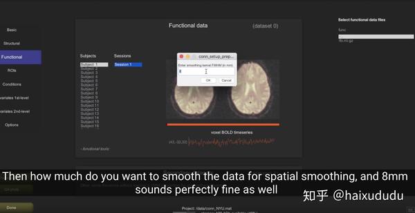 CONN使用总结1 (resting-state fMRI) - 知乎