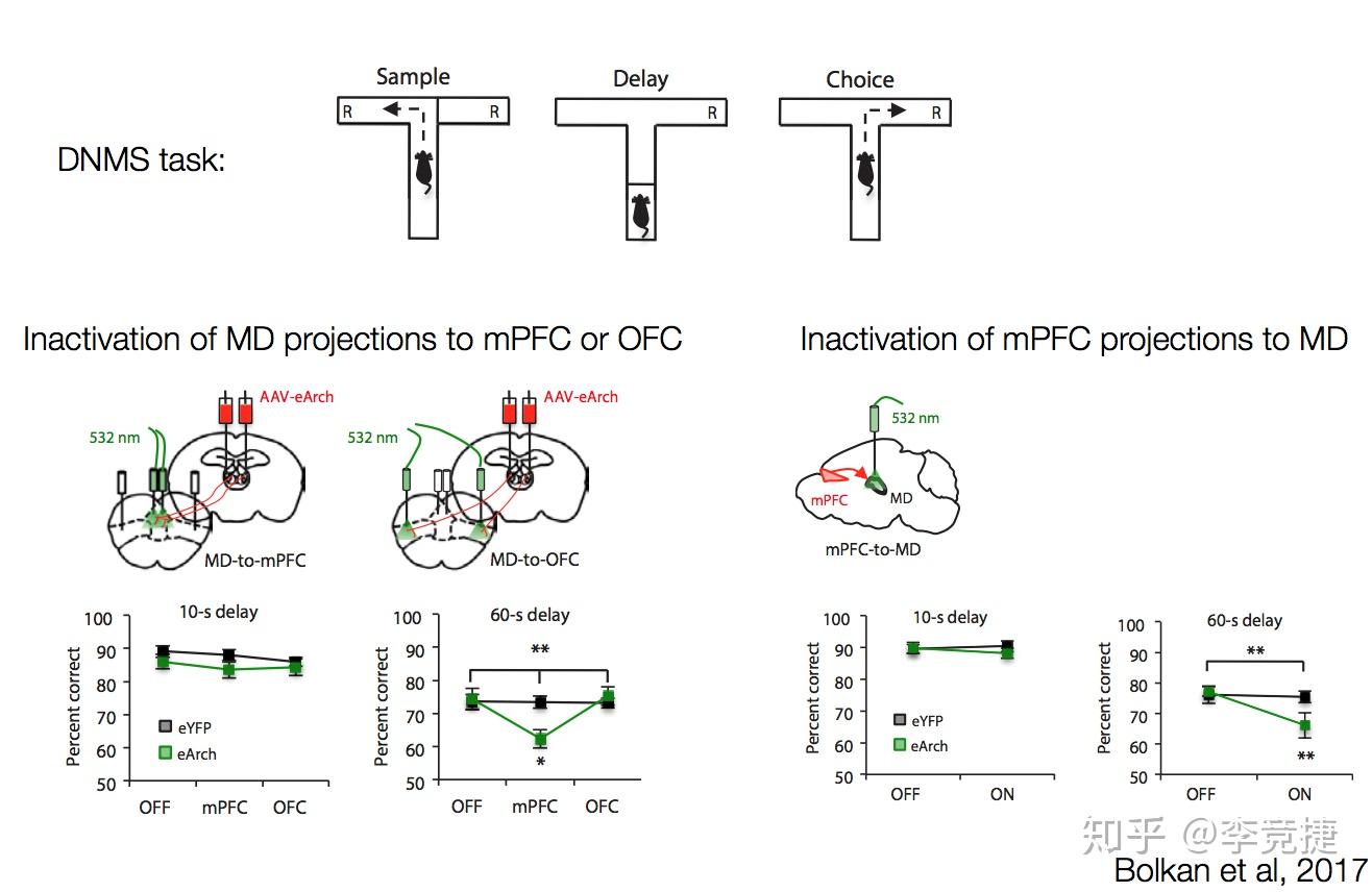 工作记忆 - 知乎