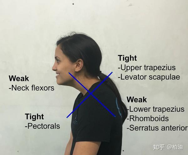 靠墙站真的可以矫正驼背伸脖子吗？ - 知乎
