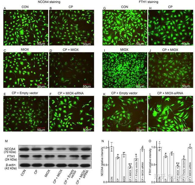 细胞病理性铁死亡？中科院一区带你探索MIOX的妙用 - 知乎