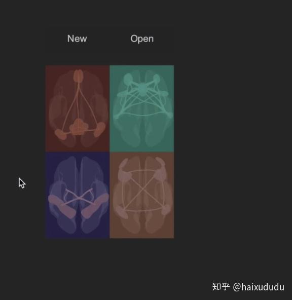 CONN使用总结1 (resting-state fMRI) - 知乎