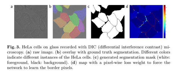 U-Net：基于小样本的高精度医学影像语义分割模型 - 知乎