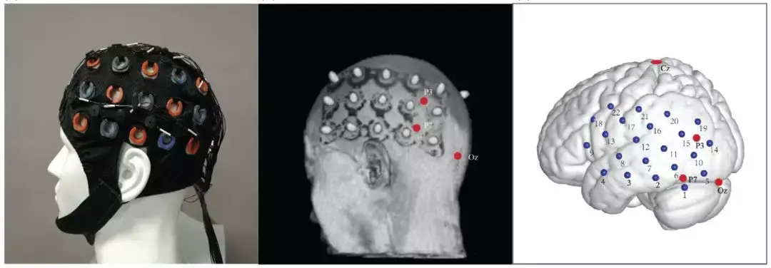 EEG和fNIRS同步联合，揭示预期对于注意选择影响的神经机制 - 知乎