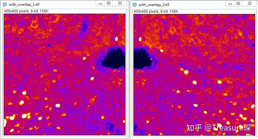 Imagej实用技巧——自动图片拼接基本功能篇 知乎