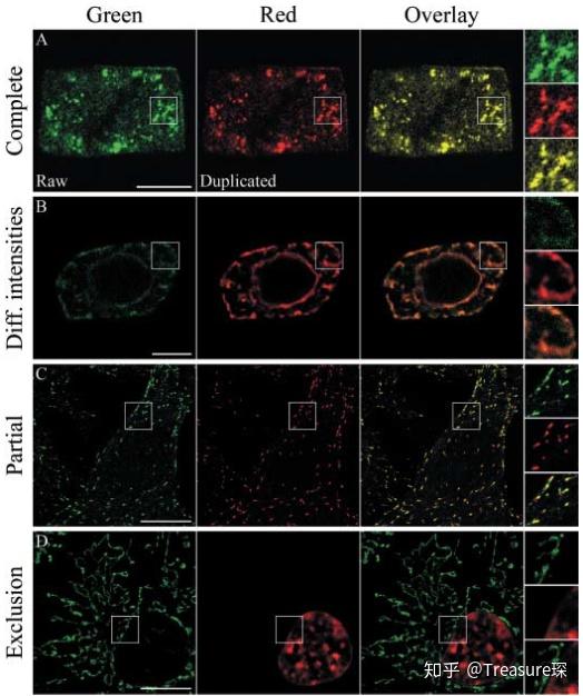 ImageJ实用技巧——荧光共定位分析原理(解析篇) - 知乎