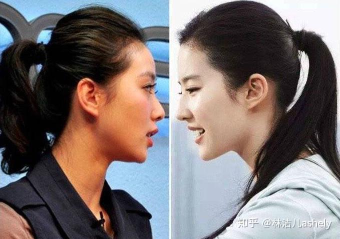 人好看连扁头也美？刘诗诗与刘亦菲的差距，就在这个颜值bug上 知乎